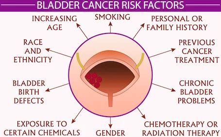 Bladder Cancer Symptoms Causes Stages Diagnosis And Treatment