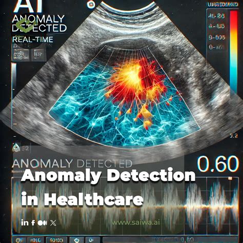 Anomaly Detection In Healthcare Improving Patient Safety