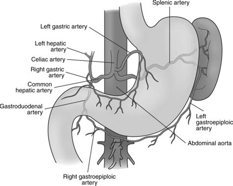 Abdominal Aortography And Genitourinary System Procedures Radiology Key