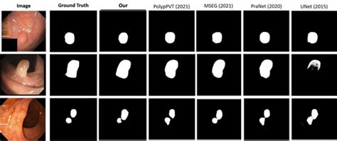 Meta Polyp A New Benchmark For Efficient Polyp Segmentation