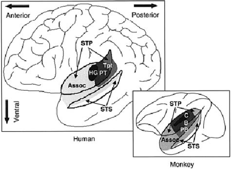 Depictions Of The Left Superior Temporal Cortex In The Human And The Download Scientific