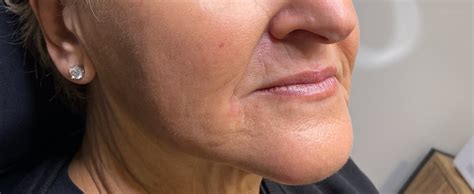 Pdo Threads My Oh My Aesthetics