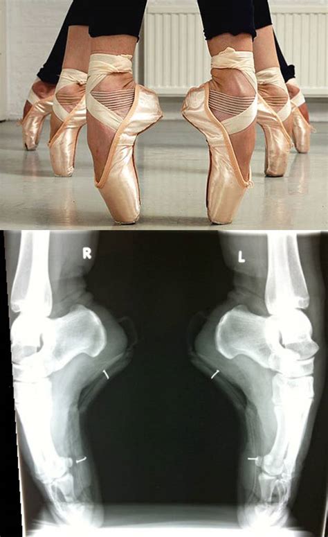 You Should Know Ballerinas Are More Hardcore Than You