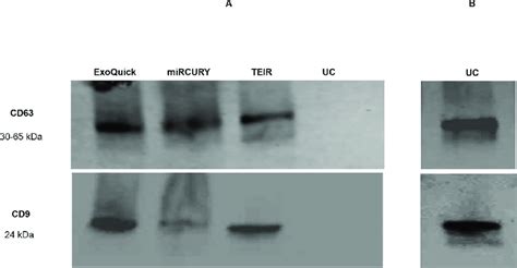 Specificities Of Exosome Versus Small Ectosome Secretion 60 Off