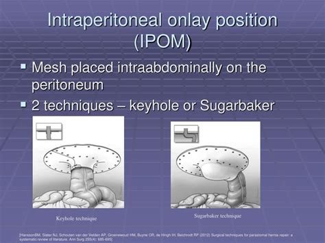 Ppt Parastomal Hernia Powerpoint Presentation Free Download Id 4928893
