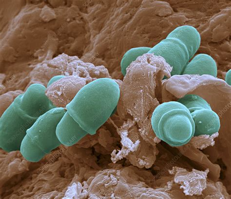 Malassezia Skin Fungus Sem Stock Image C0239923 Science Photo