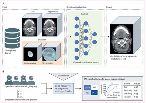 Screening For Extranodal Extension In Hpv Associated Oropharyngeal