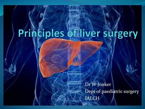 Principles Of Liver Resectionpptx