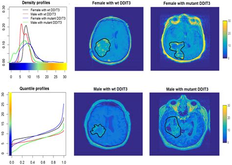 Quantile Function On Scalar Regression Analysis For Distributional Data Pmc