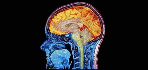 Catherine Hession On Linkedin Our Brains Are So Cool There Is No