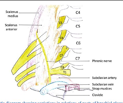 Subclavius Muscle Brachial Plexus