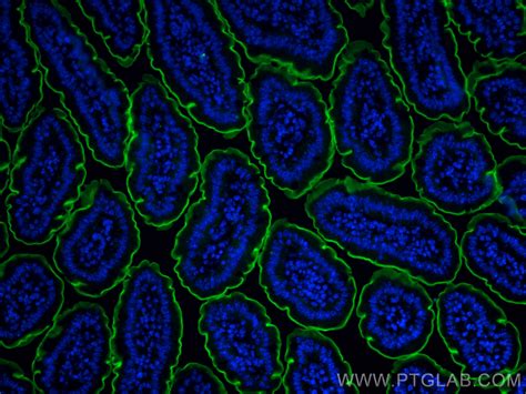 Villin Antibody Cl488 16488 Proteintech