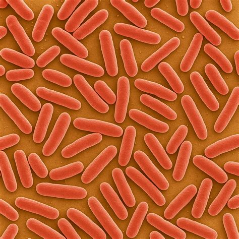 Proteus Mirabilis Tıpacı