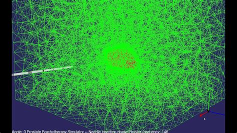 Prostate Brachytherapy Simulator 3d View Youtube