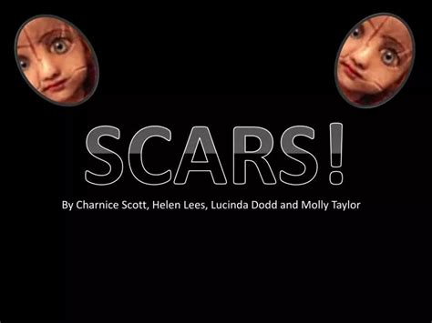 PPT SCARS PowerPoint Presentation Free Download ID 2674191