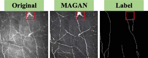 Figure 12 From Multi Scale Attention Generative Adversarial Network For Medical Image