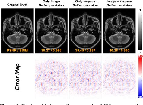 Figure 1 From Dsformer A Dual Domain Self Supervised Transformer For Accelerated Multi Contrast