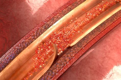 Red Whale I Gp Update Limited On Linkedin Primarycare Redwhale