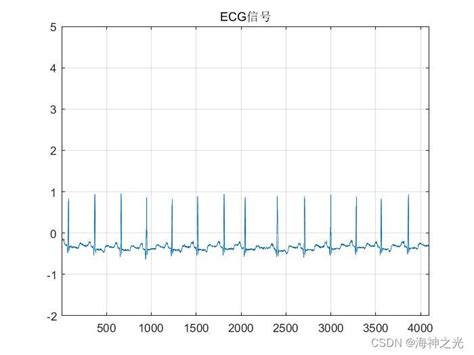 【心电信号】基于matlab心电图qrs波识别（标记）【含matlab源码 4258期】matlab处理心电信号 Csdn博客