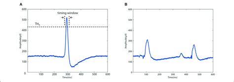 Typical Eog Waveform Of An Intended Blink A And Unintended Blinks