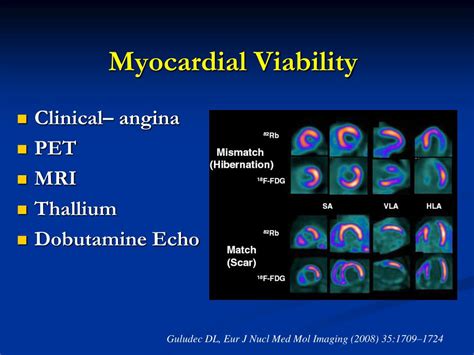 Ppt Myocardial Viability Powerpoint Presentation Free Download Id