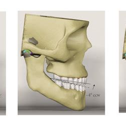 Reference Model Ref Counterclockwise CCW And Clockwise Download Scientific Diagram