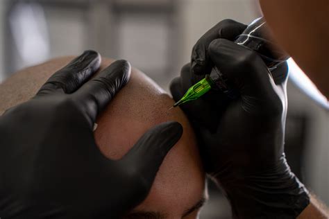 Caring For Your Skin After Scalp Micropigmentation