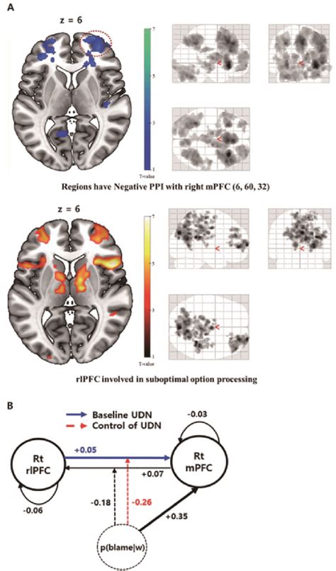 A Modulation Of Connectivity Between The Right MPFC And Other Regions Download Scientific