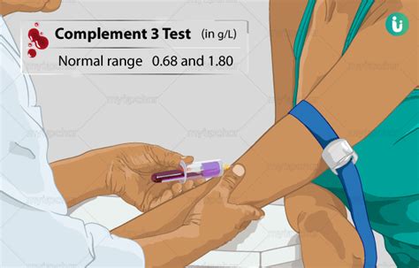 Complement 3 C3 Test Procedure Purpose Results Normal Range Cost