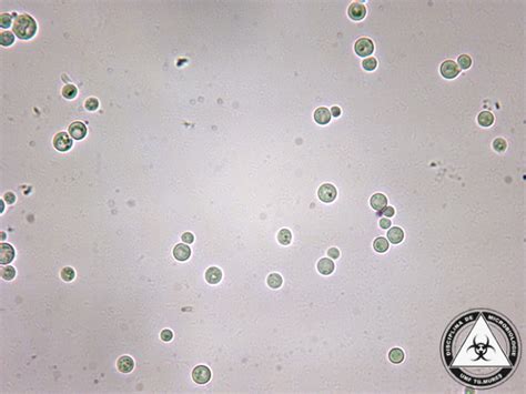 Genul Cryptococcus