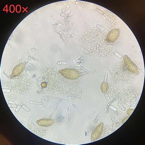 Some Rust And Mildew Rmicroscopy