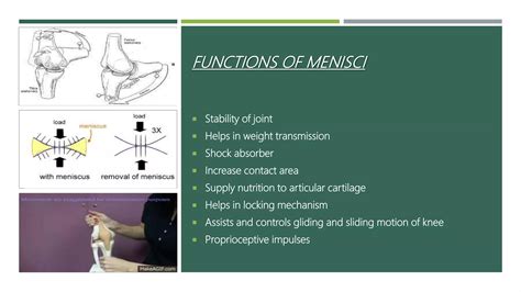 Medial Meniscus Injury And Physiotherapy Treatment Ppt