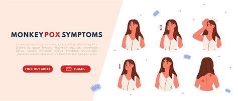 Desain Spanduk Iklan Gejala Virus Monkeypox Template Latar Belakang