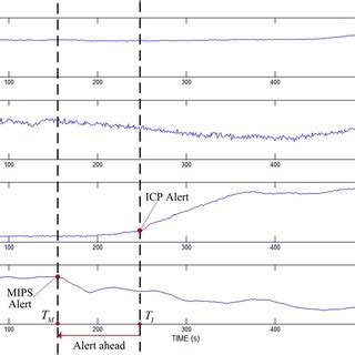 Block Diagram Of The MIPS Experimental Prototype Download Scientific Diagram