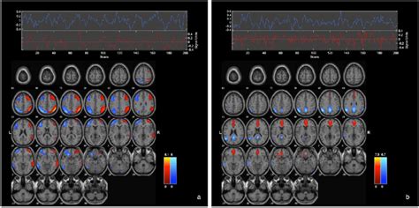 Patterns Of Functional Connectivity Within Frontoparietal A And Dmn Download Scientific