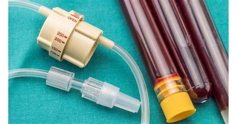 What Cause Back Pain During Period Best Recipes