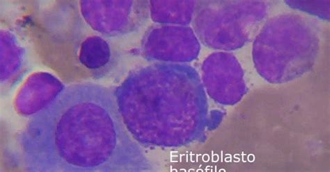 Hematologia Fichero Usac Eritroblasto Basófilo