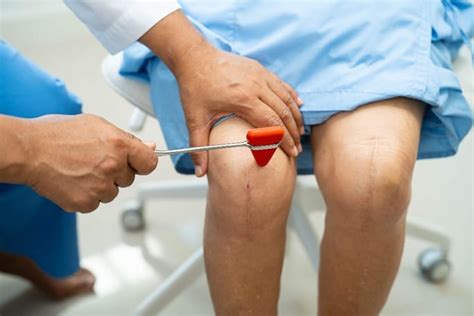 Apa Itu Arthroplasty Fungsi Prosedur Dan Efek Sampingnya Lamina
