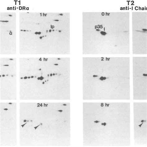 Invariant Chain Synthesized In The Absence Of Hla Class Ii Antigens Download Scientific Diagram