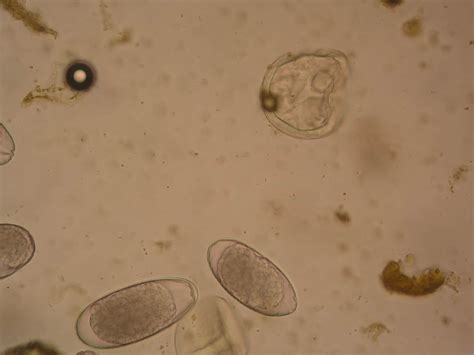 Equine Internal Parasites The Horse