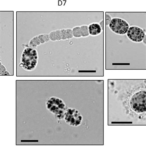 Pdf Carbon Assimilation And Accumulation Of Cyanophycin During The Development Of Dormant