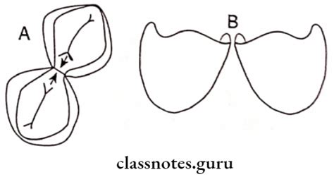 Removable Partial Dentures Class Notes