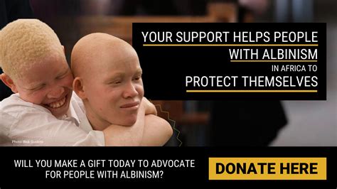 Celebrating 10 Years Of Albinism Days Africa Albinism Network