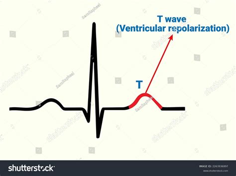 Structure T Wave Ventricular Repolarization Stock Vector Royalty Free 2263936997 Shutterstock