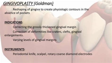 Gingivectomy And Gingivoplasty Pptx Dental Health Diseases And