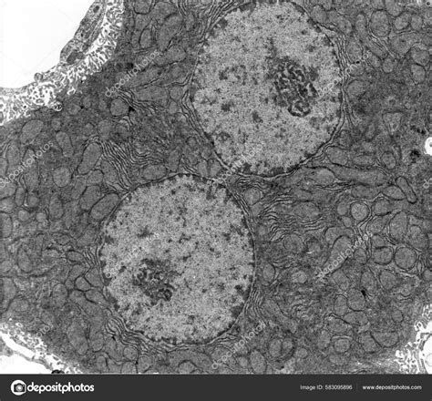 Endoplasmic Reticulum Micrograph