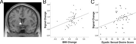 Figure 2 From Individual Differences In Nucleus Accumbens Activity To