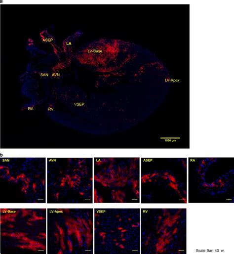 Three Dimensional Image Reconstruction Of Distribution Of Pnmt Cell