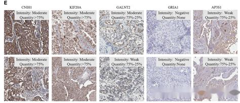 “细胞间通讯”生信新切入点—“囊泡介导的转运基因”，干湿结合不蹭热点就发8分 ，附带基因集，直接拿去复现！ 知乎