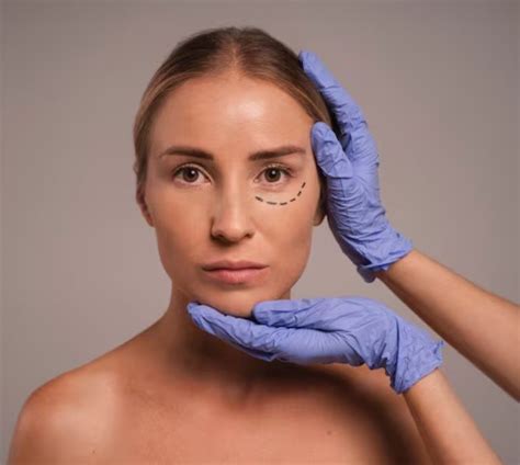 Youthlift Thread Lifting In Korea Cost Procedure Recovery And Best